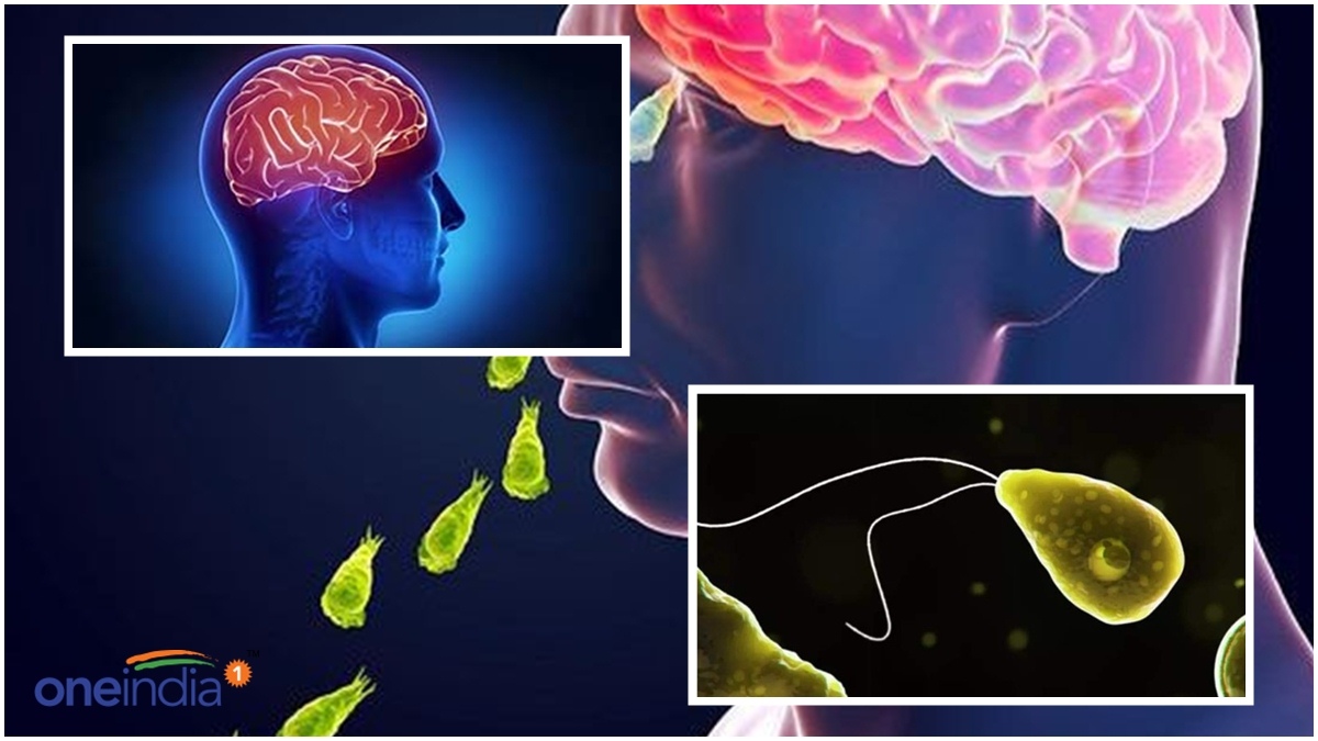 Brain Eating Amoeba : બ્રેન-ઇટિંગ અમીબાના સંક્રમણને કારણે 15 વર્ષીય ...